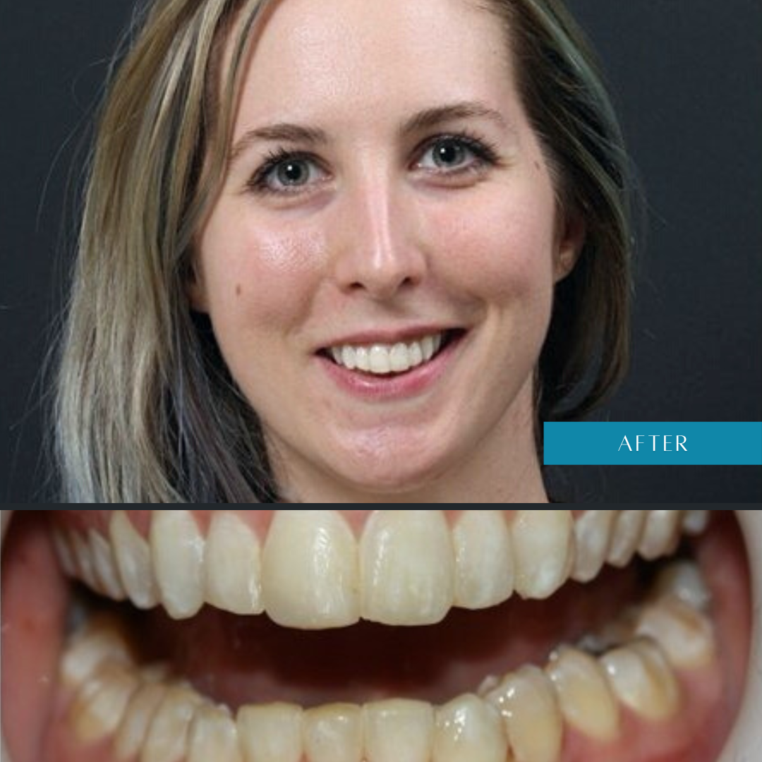 New Year's Resolutions: What is a S.M.A.R.T. Goal and Why Does Making ...